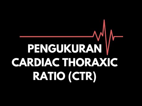 First time, Belajar mengukur CTR Normal & Cardiomegali nih!!