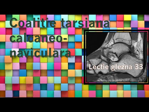 lectie glezna 33