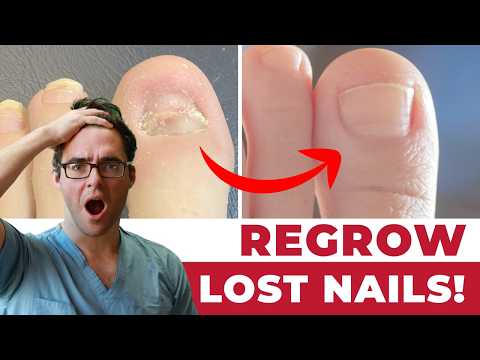 Horizontal Ridges on Toenails: 7 Causes & Best Treatment