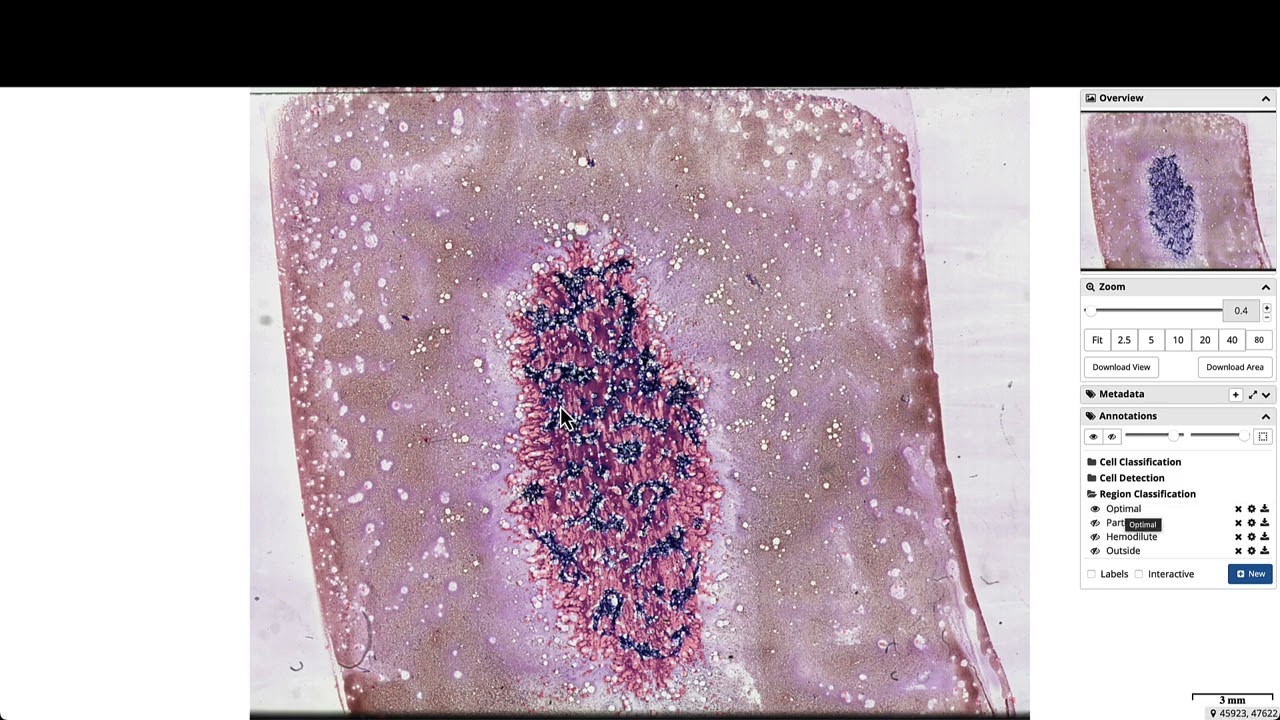 Bone marrow differential visualization