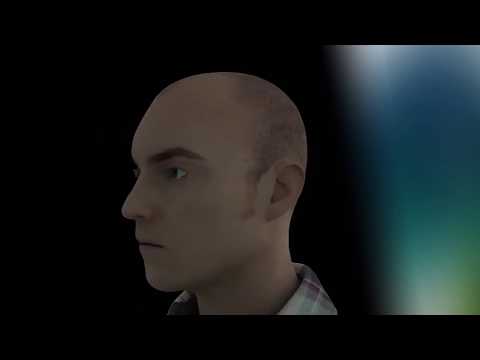 FUE Hair Transplant Procedure Animation Hair Transplant in Bhubaneswar