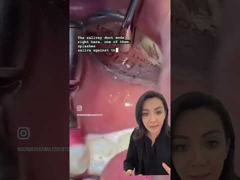Why you need a dental clean 🧽 and scale 🦷 #dentalclinic #healthyteeth #dentalcleaning