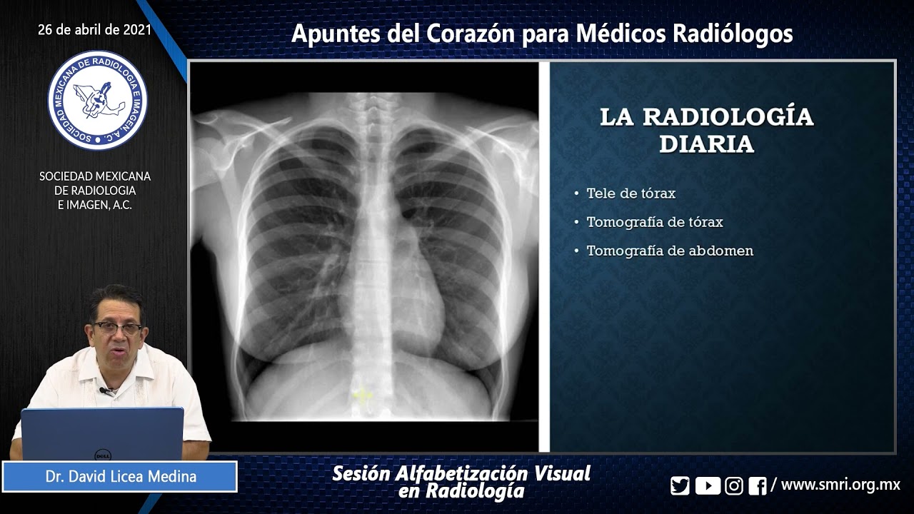 Sesión de Alfabetización Visual: Apuntes del Corazón para Médicos Radiólogos