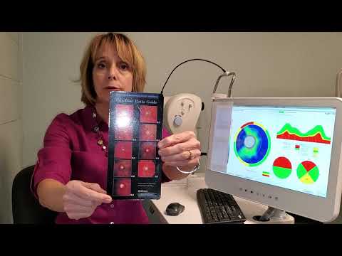 Glaucoma Testing & Treatment at Aloma Eye Associates