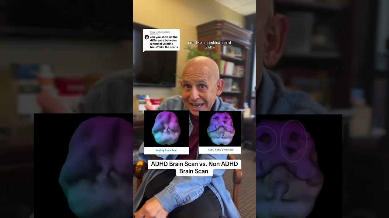 ADHD Brain Scan vs. Neurotypical Brain Scan