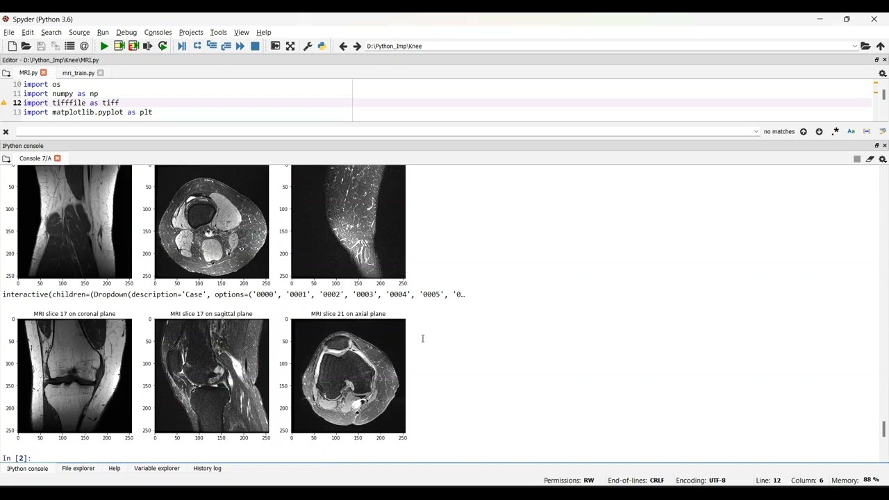 Federated Multi Task Learning for Joint Diagnosis of Multiple Mental ...