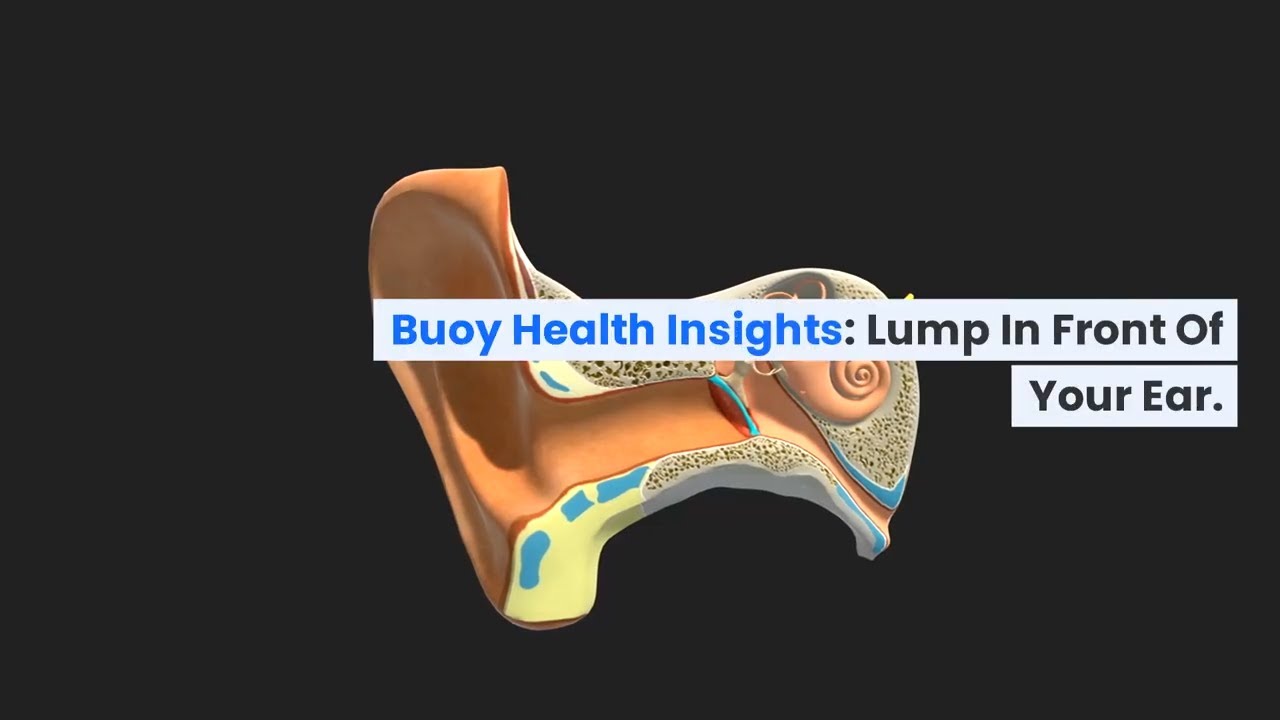 Lump in Front of Your Ear: Common Causes and When to Seek Medical Care  | BuoyHealth.com