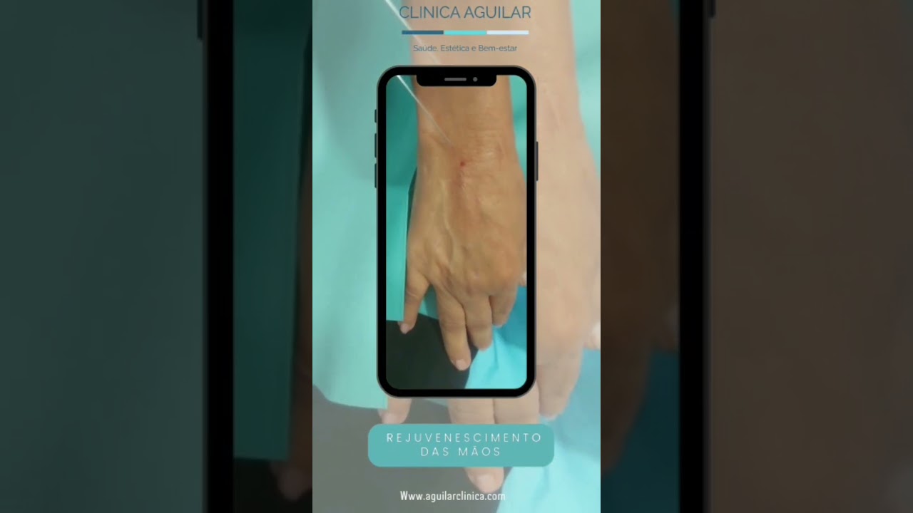 rejuvenecimiento das mãos
