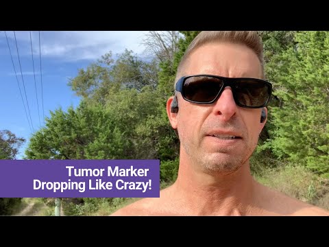 Tumor Marker Dropping Like Crazy! Latest Bloodwork & Chemo Round 9