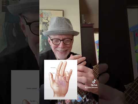 Guitar Players (Older guitarists, actually) Doc visit today for arthritis & trigger finger!
