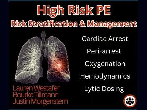 Ep 204 High Risk Pulmonary Embolism Management