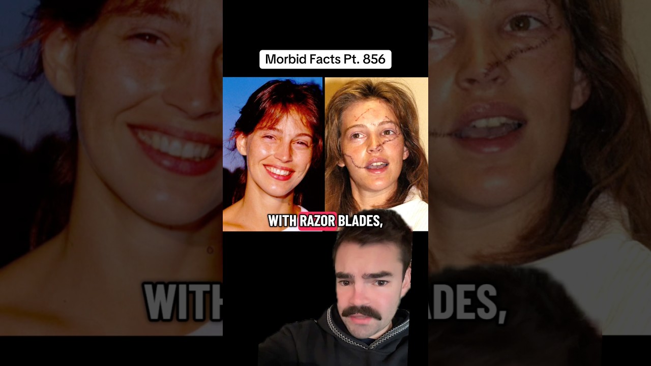 The HORRIFIC slashing of NYC model Marla Hanson #morbidfacts