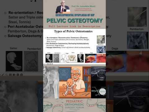Pelvic Osteotomy Types Explained | DDH Treatment #ddh #ortho #pediatrics #doctor #hip #consultant