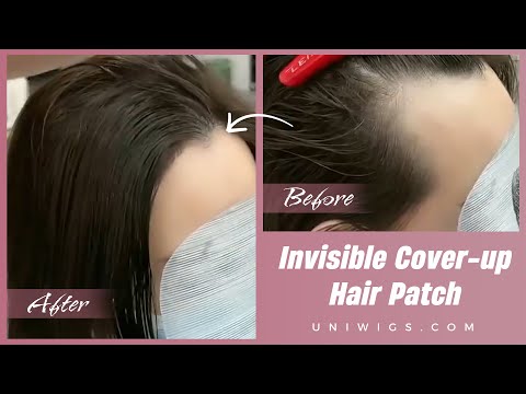 INVISIBLE Cover-up Hair Patches! PERFECT for hair-loss women!