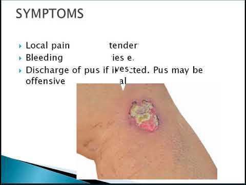 WOUND MANAGEMENT