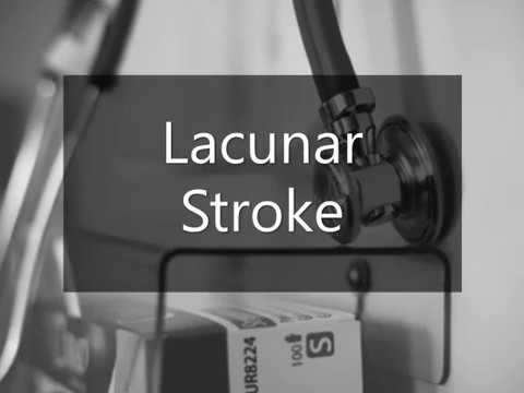 Learn how to pronounce Lacunar Stroke.