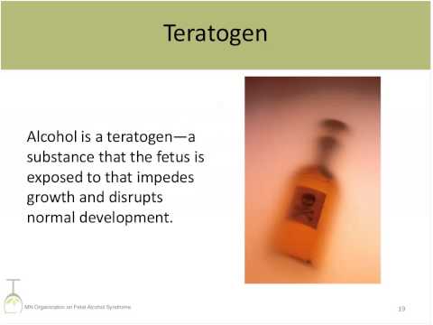 MOFAS: Fetal Alcohol Spectrum Disorder Basics Webinar