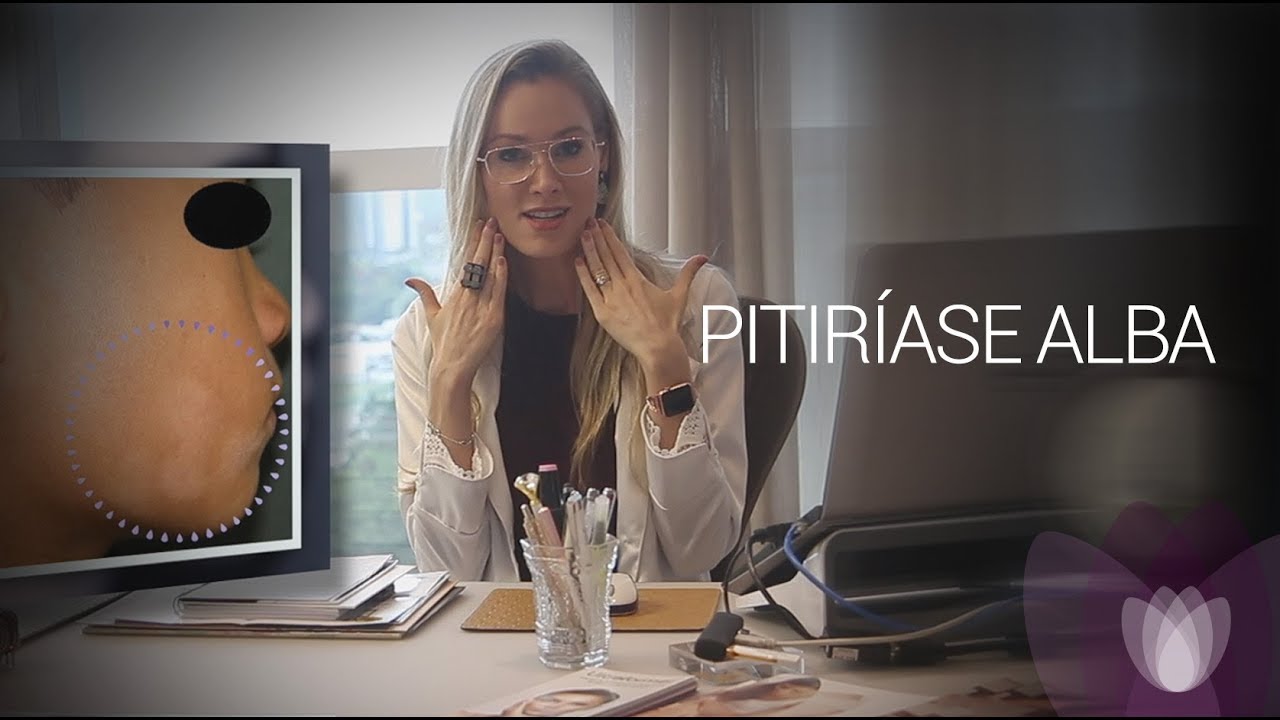 PITIRÍASE ALBA - Dra. Gabriela Schaefer - Dermatologista