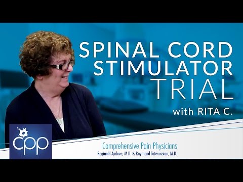 Spinal Cord Stimulator trial - Rita