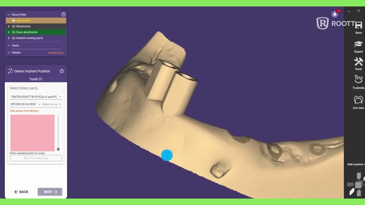 ROOTT R Connection: How to Select the Right Scan Body Libraries
