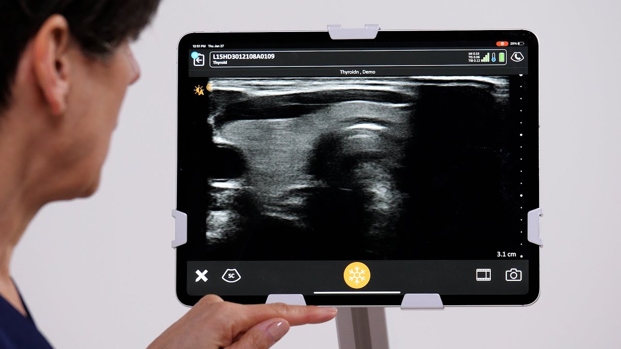 Basic Thyroid U/S Protocol