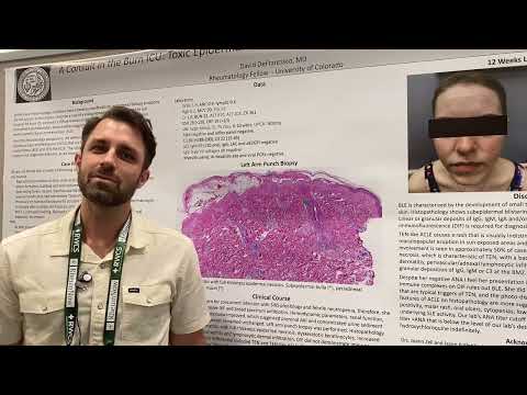 A Consult in the Burn ICU: Toxic Epiderman Necrolysis vs Acute Cutaneous Lupus Erythematosus