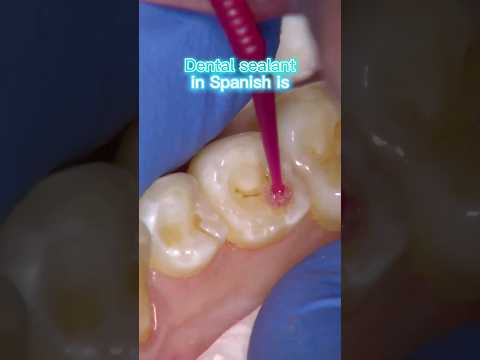 DENTAL SEALANT IN SPANISH | Medical Consecutive Interpreting