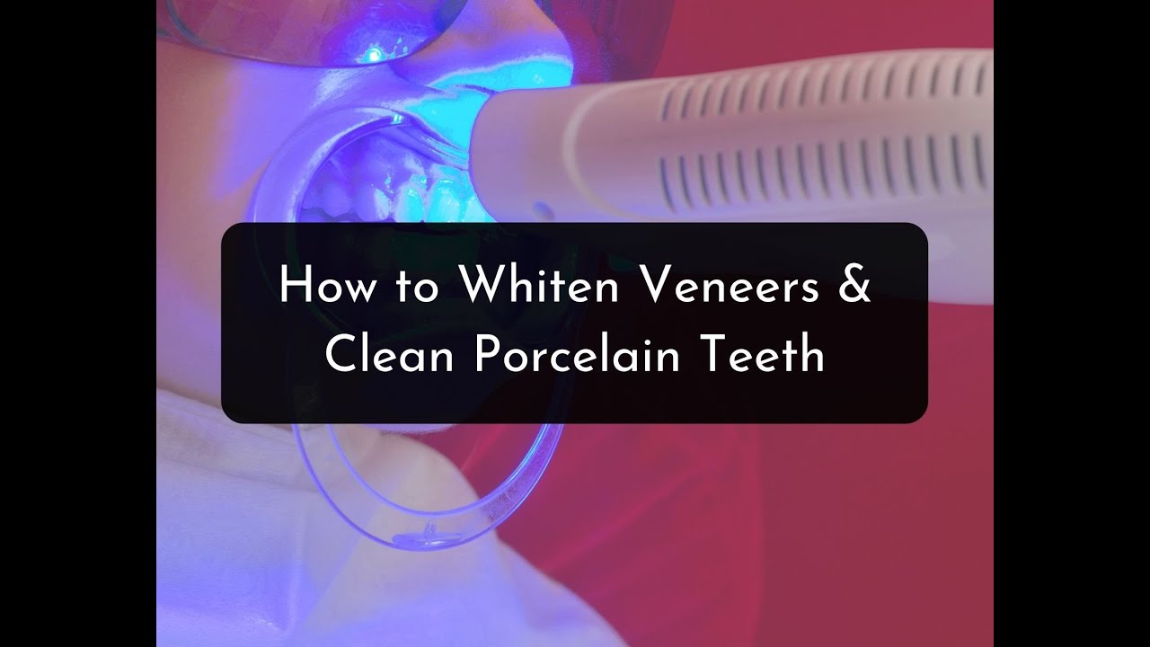 How to Whiten Veneers & Clean Porcelain Teeth