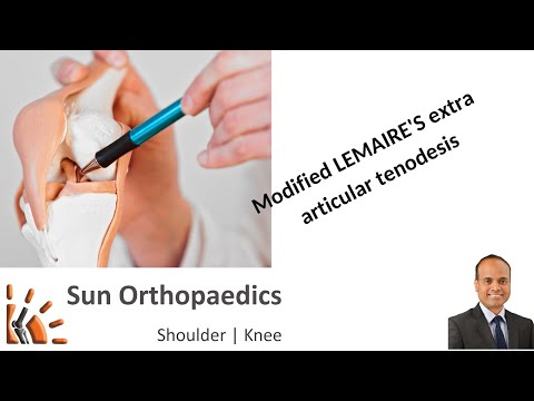 Modified Lemaire's Extra articular Tenodesis | Sun Orthopaedics | Dr Dharmapal