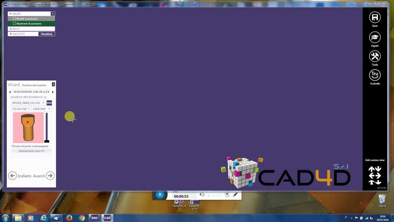 BTLock CAD CAM library - Exocad