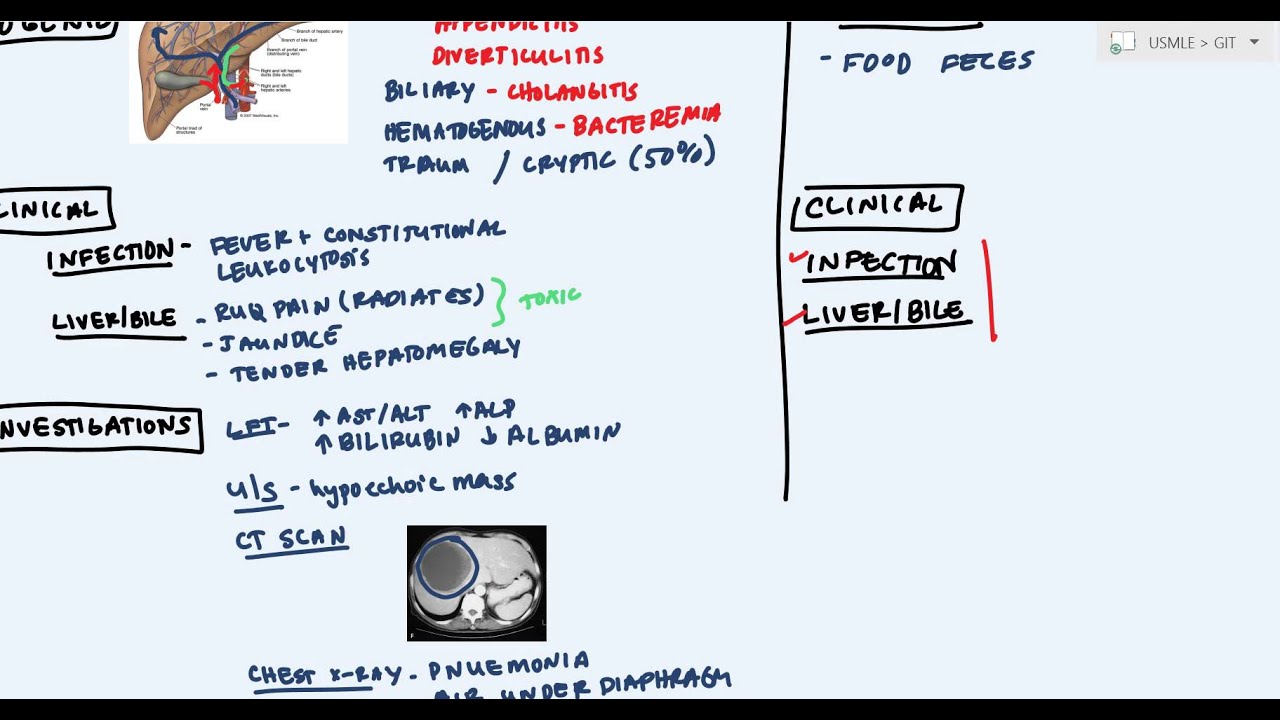 Liver, Biliary and Pancreatic Disease - Med طب