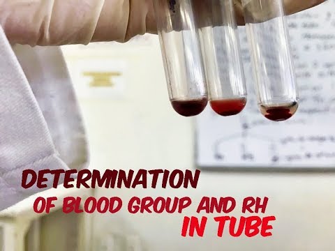 Blood Test Tube - Blood Sample Tube Latest Price, Manufacturers & Suppliers