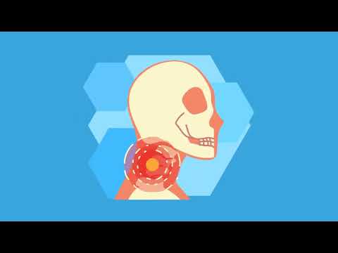 Carotid Artery Disease
