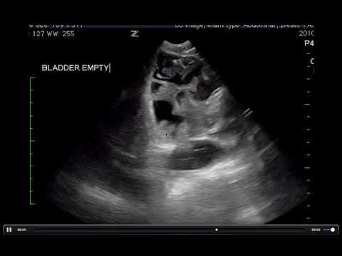 Advanced Abdominal Ultrasound