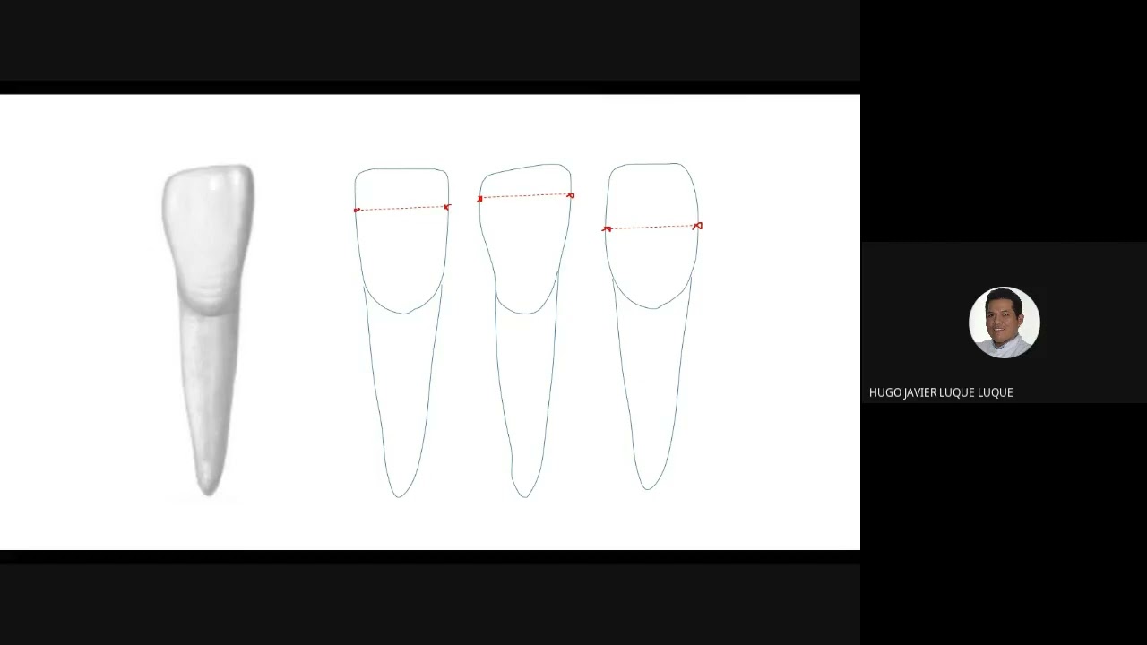 7 ANALISIS DENTICIÓN MIXTA