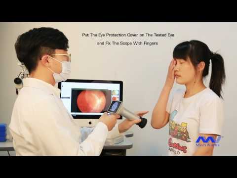 Fundus Camera - Retinal Camera Latest Price, Manufacturers & Suppliers