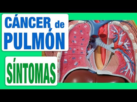 Cáncer de Pulmón - Síntomas