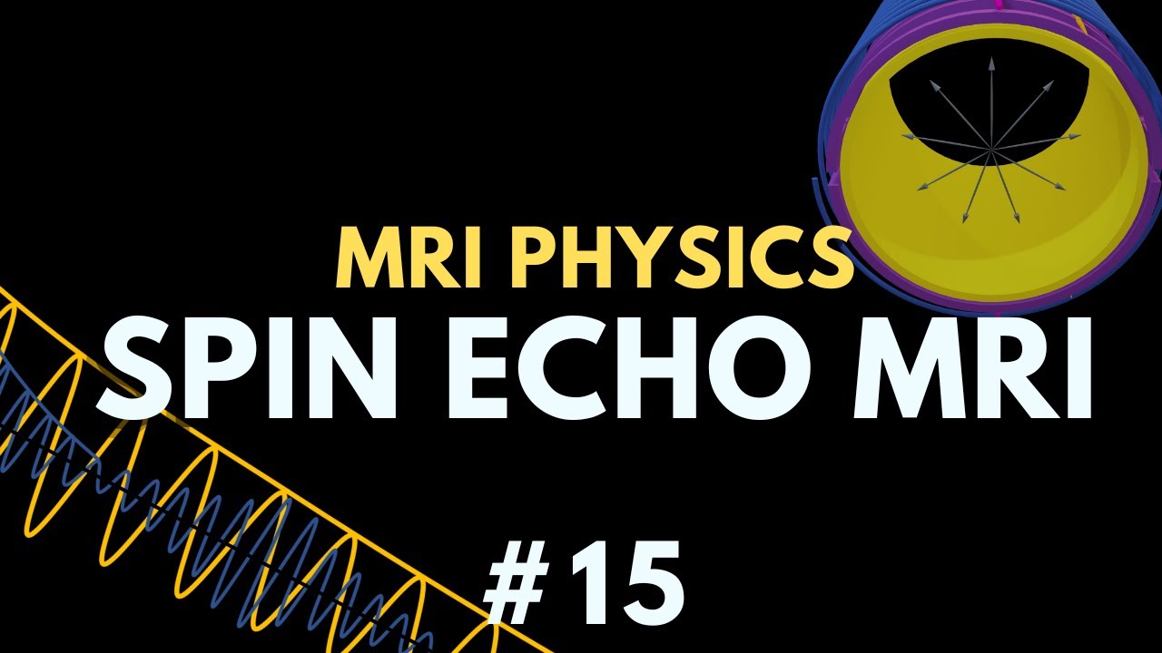 Understanding Spin Echo MRI Pulse Sequences: A Comprehensive Guide ...