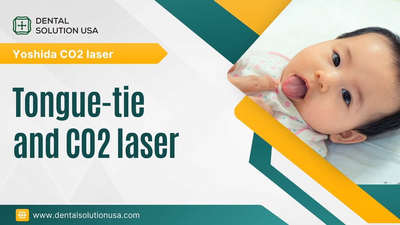 Tongue-tie and CO2 laser