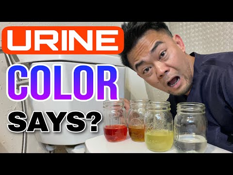 What Your Urine Color Says About You