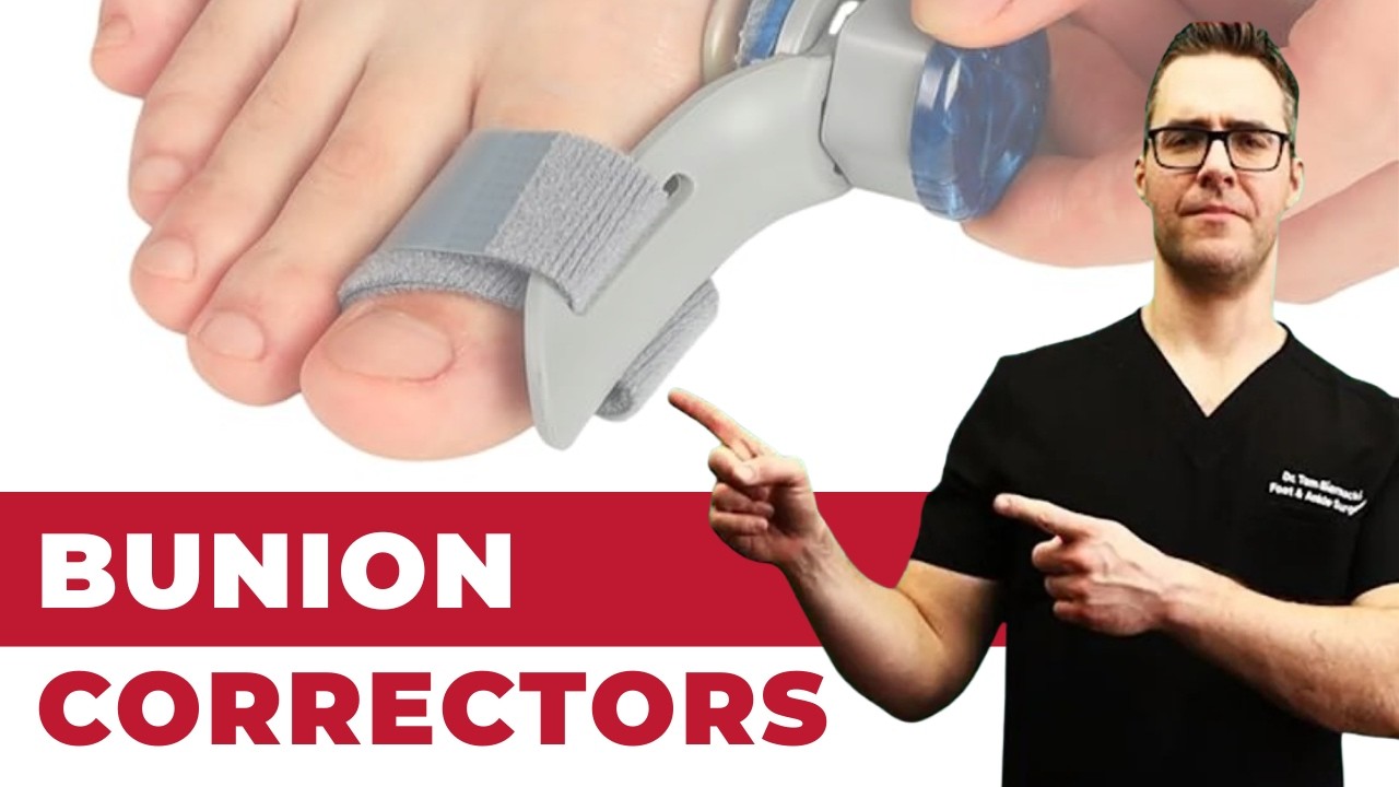 Do Bunion Correctors Work? [How To SHRINK Bunions Naturally!]
