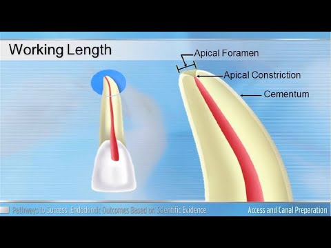 Apex Locators - Dental Apex Locators Latest Price, Manufacturers ...