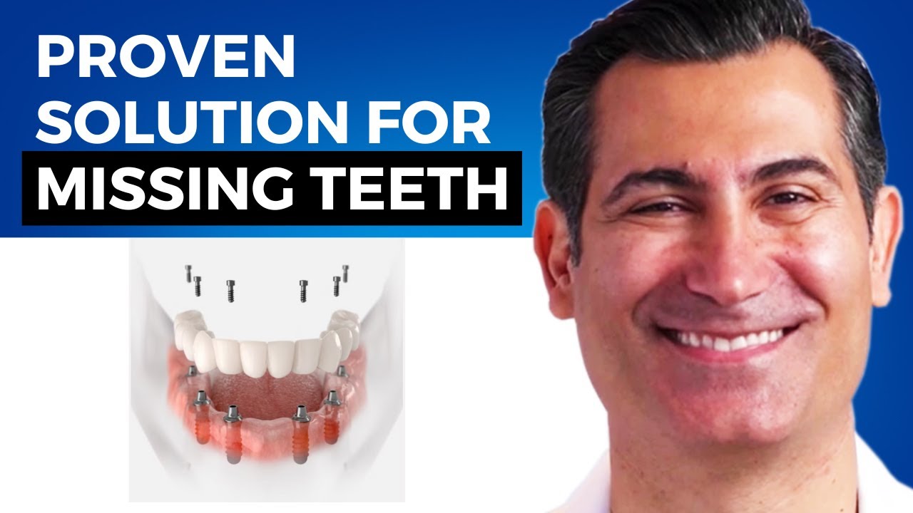 True Cost of All On 4  Dental Implants (Allen, Texas)