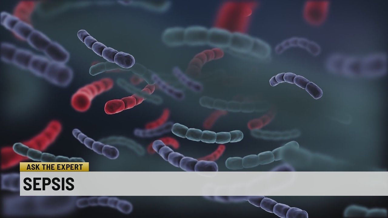 What is Sepsis and why is early treatment so critical