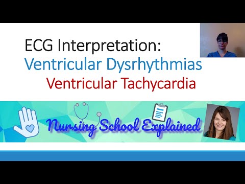 Ventricular Tachycardia (VTach)