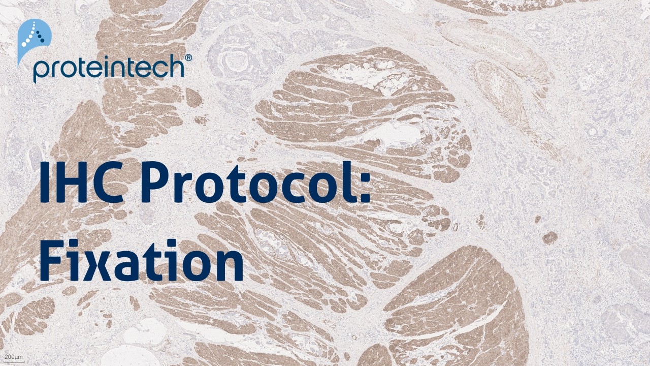 Immunohistochemistry (IHC): Fixation Protocol