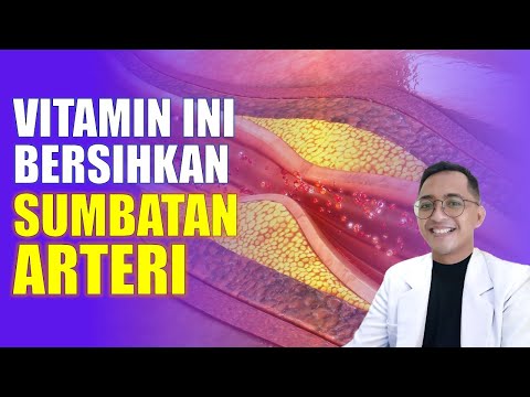 Pembuluh Darah Tersumbat? Atasi dengan Vitamin Ini!
