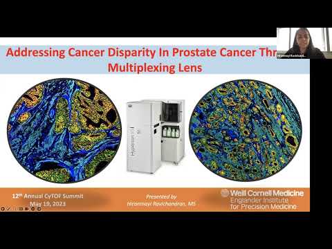 Addressing Cancer Disparity in Prostate Cancer Through Multiplexing Lens