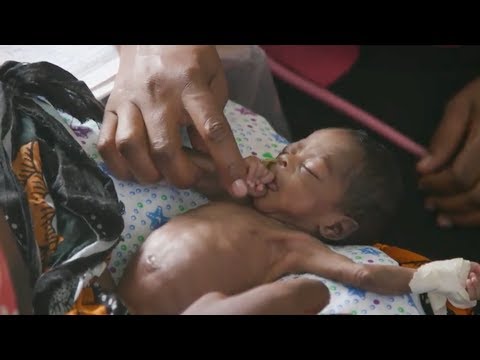 The UCSF East Africa Preterm Birth Initiative