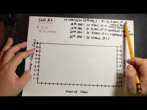 How to make you own (“DIY”) partogram – Doc Ina Ob Gyne
